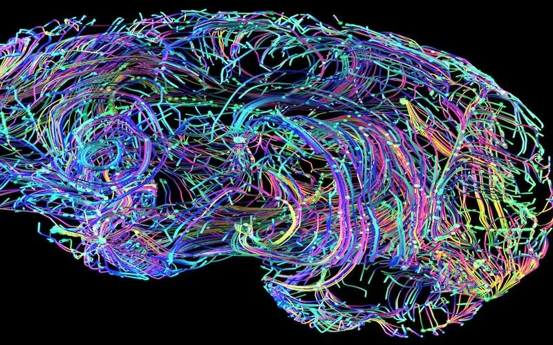 Neurons in a dish learn to play Pong | Brian Patrick Green » IAI TV