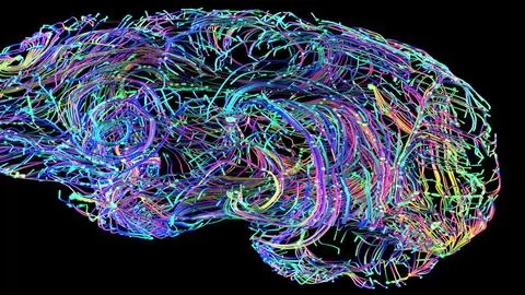Neurons in a dish learn to play Pong | Brian Patrick Green » IAI TV